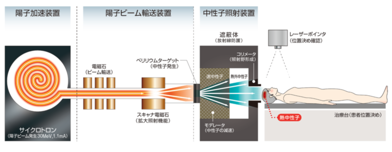 BNCT（ホウ素中性子捕捉療法）について、治療方法と治療効果について医師が解説